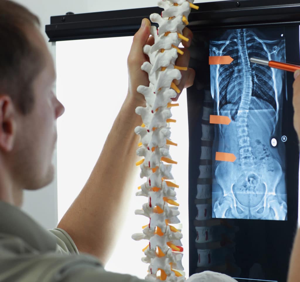 Spine Anatomy | CT Spine & Orthopedic