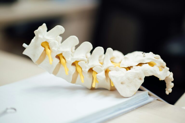 Vertebral Augmentation | CT Spine & Orthopedic